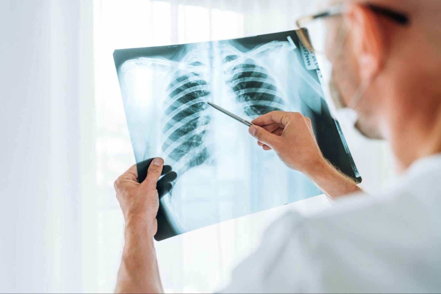 Diferencia entre neumonía y pulmonía | HCB Hospitales